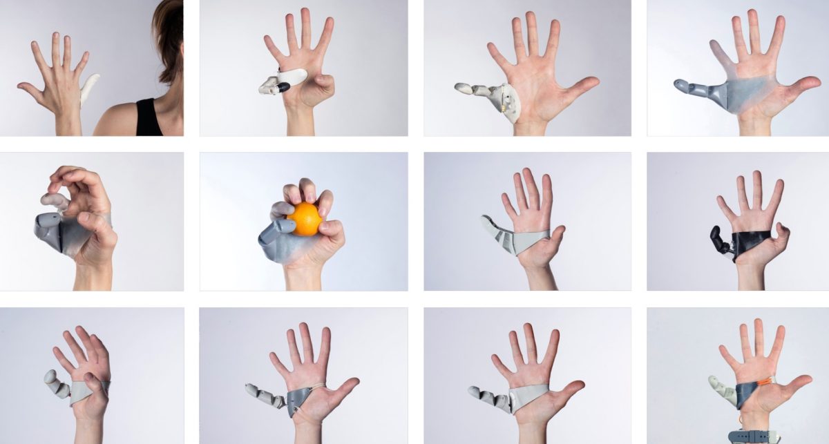 Having two left thumbs may no longer be a bad thing - Sify